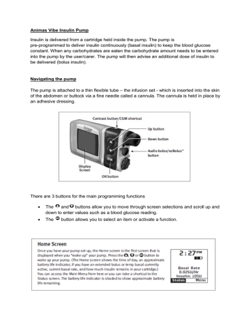 Animas Vibe Insulin Pump User Manual | Manualzz