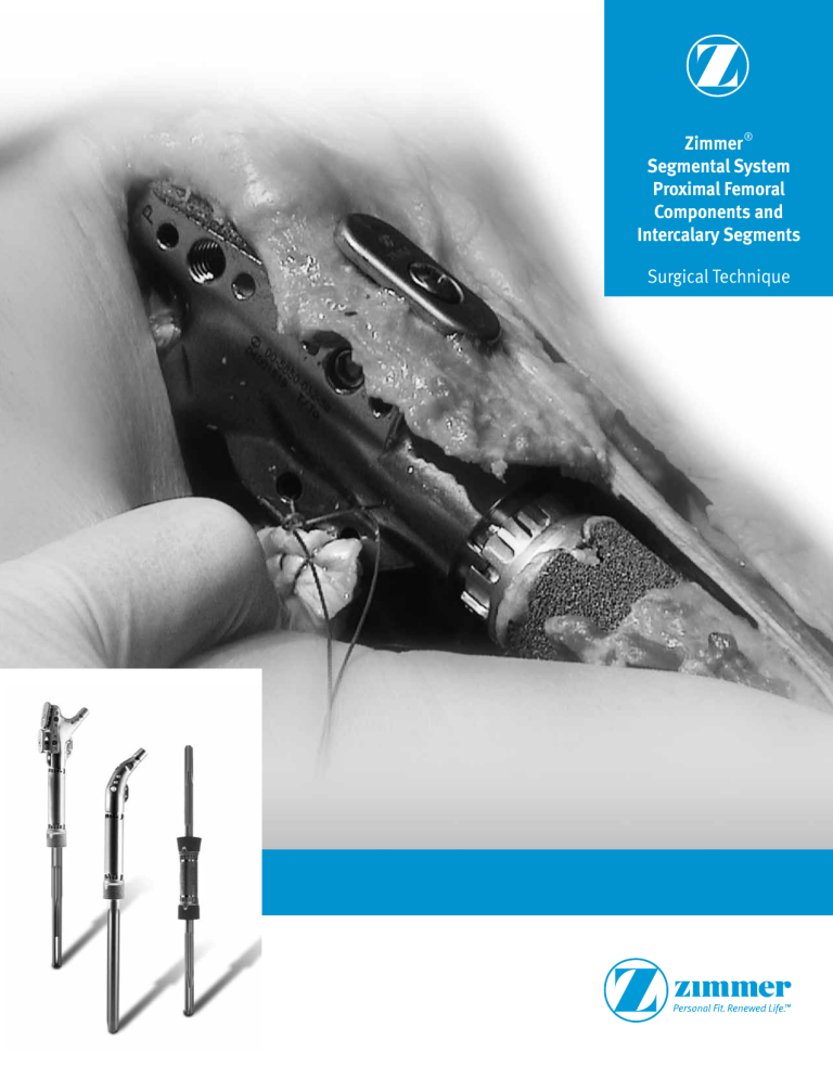 Zimmer® Segmental System Proximal Femoral Components and | Manualzz