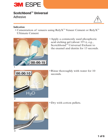 3M RelyX™ Veneer Cement Application Guide - Read Online | Manualzz