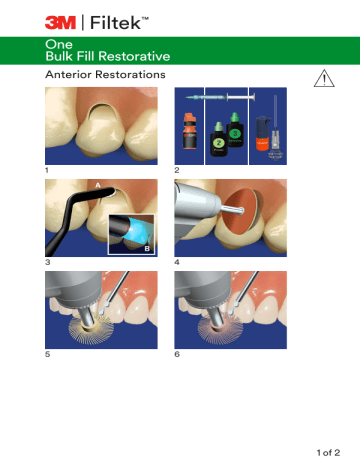 3M Filtek™ One Bulk Fill Restorative Application Guide | Manualzz