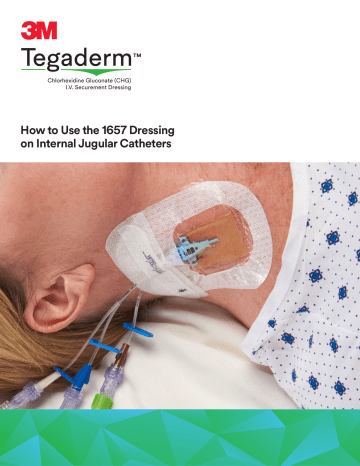 3M Tegaderm™ CHG Chlorhexidine Gluconate I.V. Securement Dressing ...