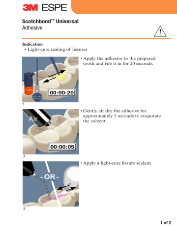 3M Scotchbond™ Universal Adhesive Application Guide | Manualzz