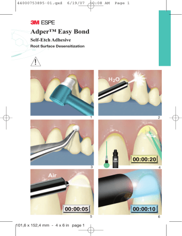 3M Adper™ Easy Bond Self-Etch Adhesive Application Guide | Manualzz