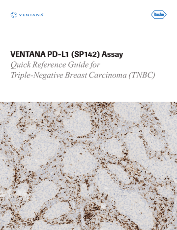 Roche BenchMark GX Interpretation Guide | Manualzz