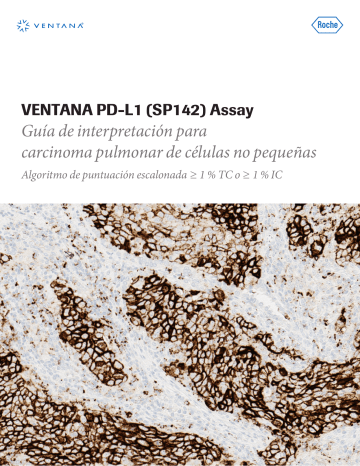 Roche VENTANA PD-L1 (SP142) Assay Manual de usuario | Manualzz