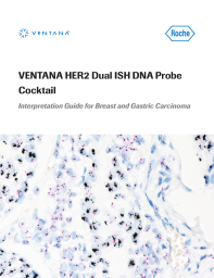 Roche BenchMark ULTRA - Operator's manual, Reference guide
