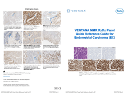 Roche BenchMark ULTRA - Operator's manual, Reference guide