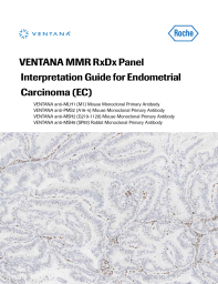 Roche BenchMark ULTRA - Operator's manual, Reference guide