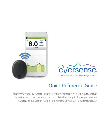 senseonics eversense Quick Reference Manual | Manualzz