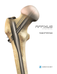 Zimmer AFFIXUS Hip Fracture Nail System Owner's Manual | Manualzz