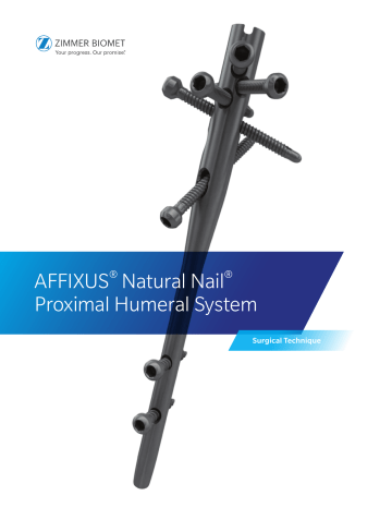 Zimmer AFFIXUS Natural Nail Humeral System Owner's Manual | Manualzz