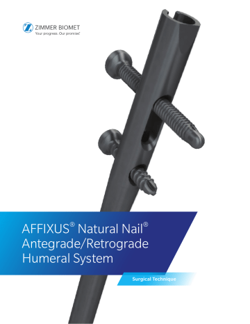 Zimmer AFFIXUS Natural Nail Humeral System Owner's Manual | Manualzz