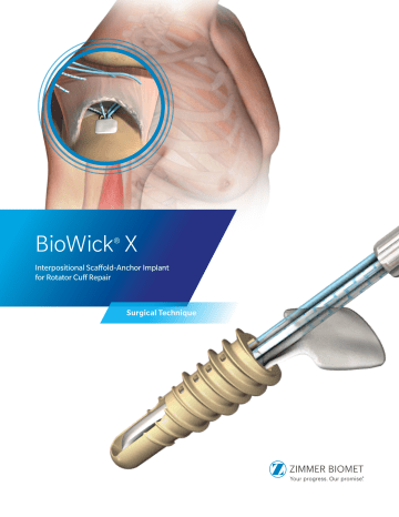 Zimmer BioWick Implants Owner's Manual | Manualzz