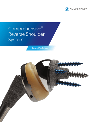 Zimmer Comprehensive Reverse Shoulder System Owner's Manual | Manualzz