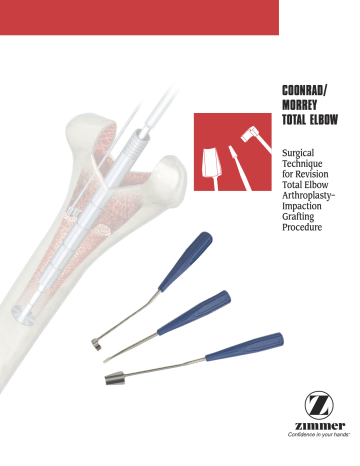 Zimmer Coonrad/Morrey Elbow Owner's Manual | Manualzz