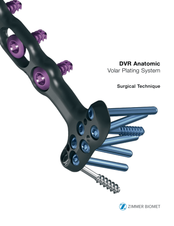 Zimmer DVR Plating System Owner's Manual | Manualzz