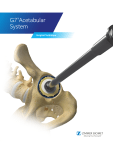 Zimmer Biomet G7 Acetabular System Surgical Technique + AI | Manualzz