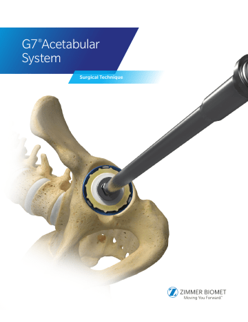 Zimmer G7 Acetabular System Owner's Manual | Manualzz