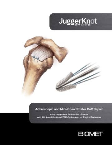 Zimmer JuggerKnot All-Suture Anchors Owner's Manual | Manualzz