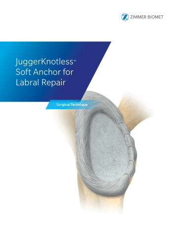 Zimmer JuggerKnot All-Suture Anchors Owner's Manual | Manualzz
