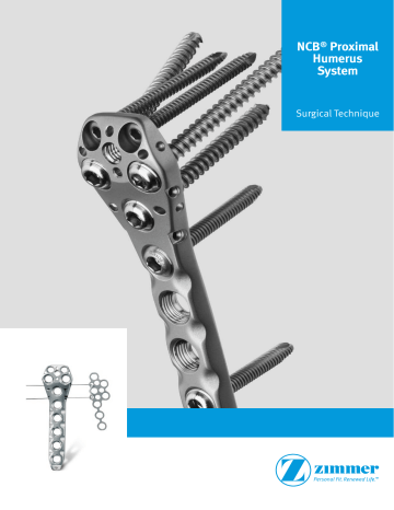 Zimmer NCB Proximal Humerus Plating System Owner's Manual | Manualzz