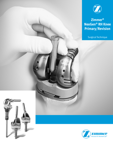Zimmer NexGen Complete Knee Solution Owner's Manual | Manualzz