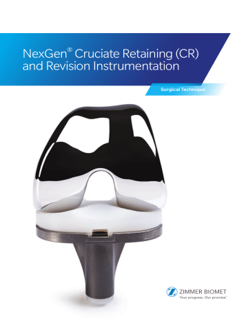 Zimmer NexGen Complete Knee Solution Owner's Manual | Manualzz