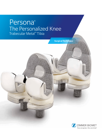 Zimmer Persona The Personalized Knee Owner's Manual | Manualzz
