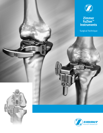 Zimmer Persona The Personalized Knee Owner's Manual | Manualzz