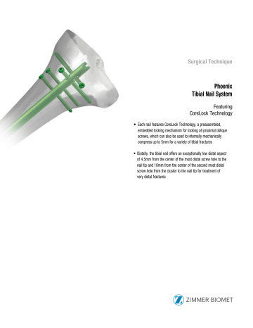 Zimmer Phoenix™ Tibial Nail System Owner's Manual | Manualzz