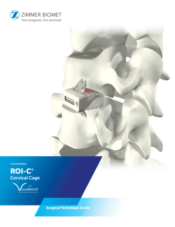 Zimmer ROI-C Cervical Cage With VerteBRIDGE Plating Technology Owner's ...