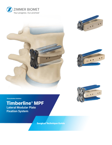 Zimmer Timberline Lateral Fusion System Owner's Manual | Manualzz
