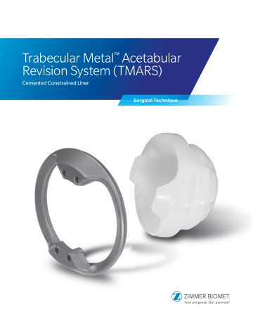 Zimmer Trabecular Metal™ Acetabular Revision System Owner's Manual ...