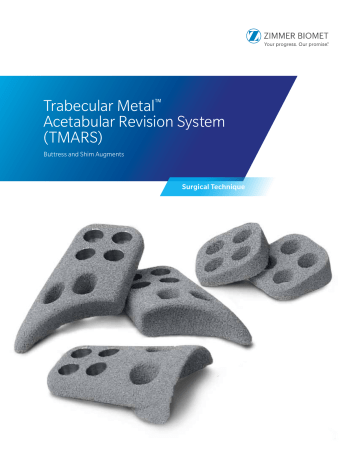 Zimmer Trabecular Metal™ Acetabular Revision System Owner's Manual ...