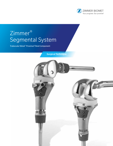 Zimmer Segmental System Owner's Manual | Manualzz