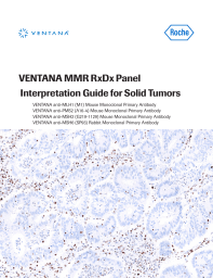 Roche BenchMark ULTRA - Operator's manual, Reference guide
